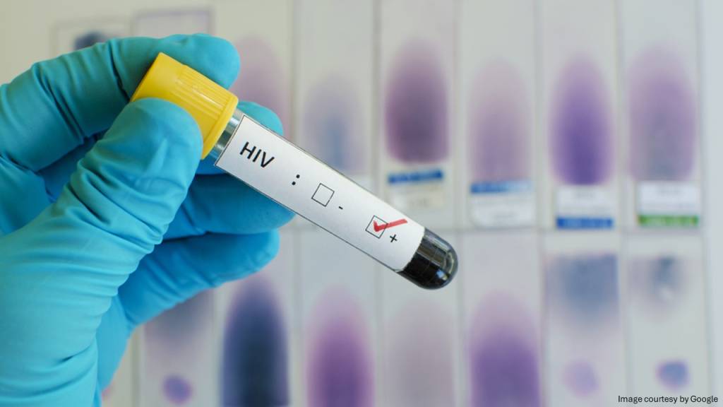6 Ways to Prevent AIDS: Essential Strategies for Protection