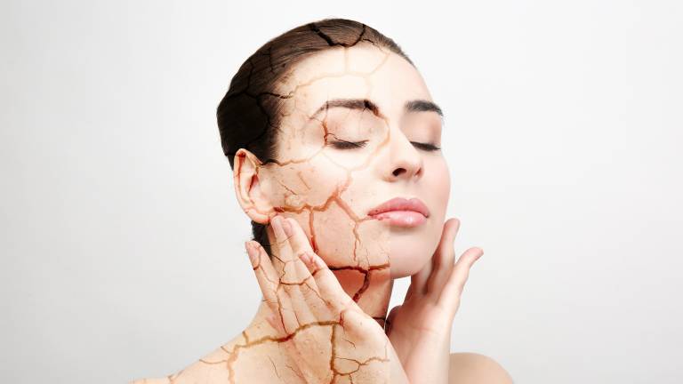 Top 10 Tips for Relieving Dry Skin