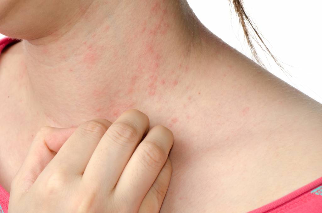 Common Causes of Skin Problems. How to avoid skin problems?