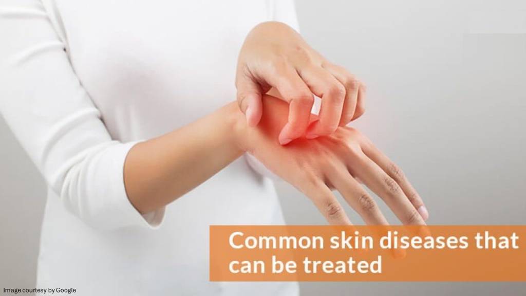Understanding Skin Problems: Causes and Prevention Strategies Revealed
