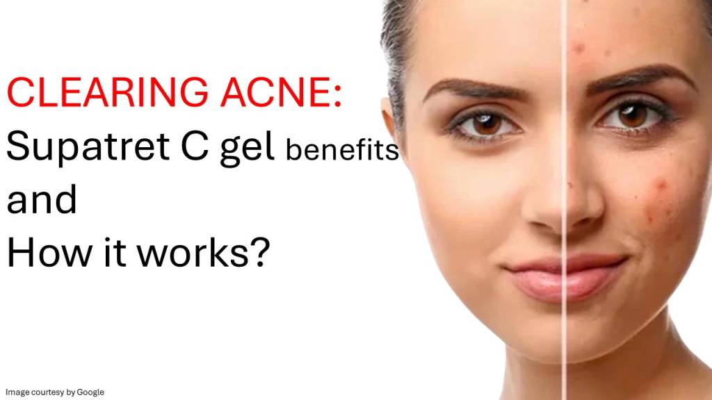 Supatret 0.04 Gel: Your Solution to Acne Woes Unveiled - All Day Chemist