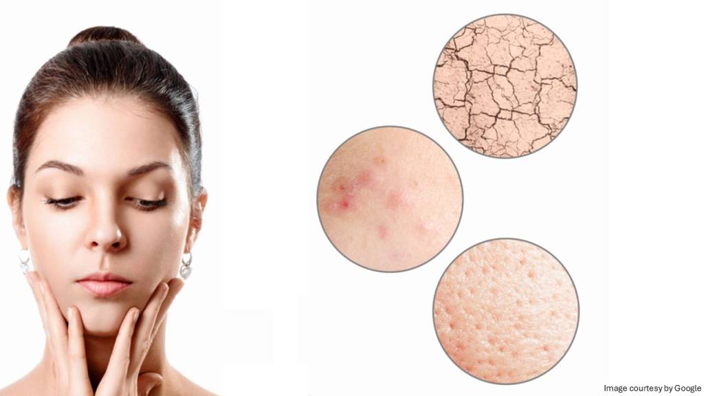 Tazret Gel Benefits & Side Effects | All About Tazorac Gel