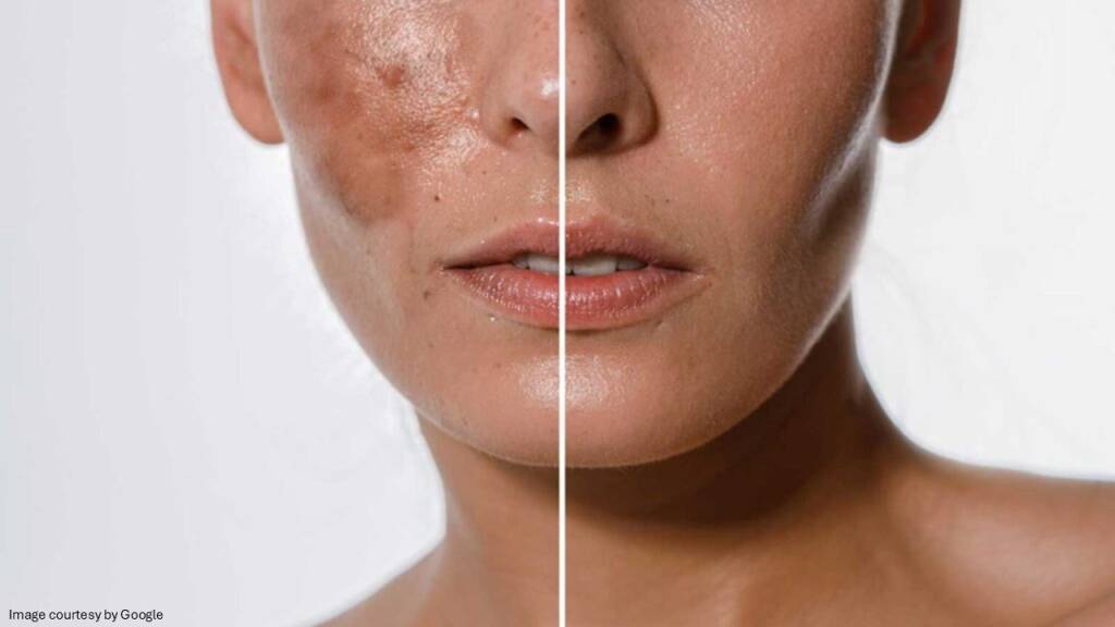 Triluma Cream: Benefits, Uses, and How It Transforms Skin Health